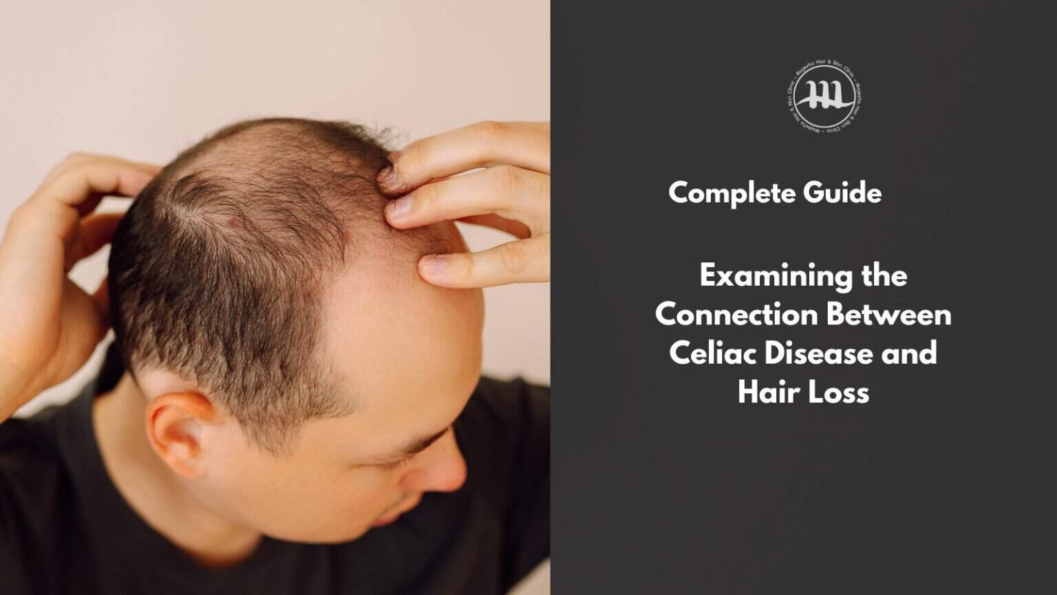 What Are Hair Plugs? Complete Guide & Why They’re Outdated